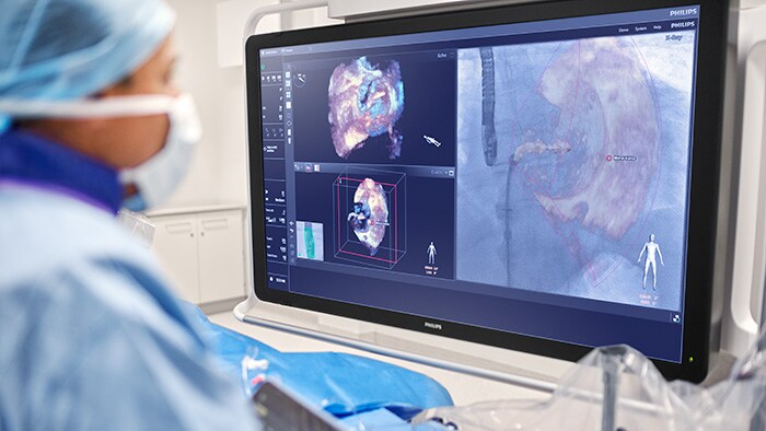 SHD suite - Image Guided Therapy | Philips Healthcare