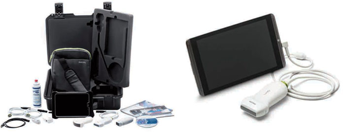 Philips Launches Lumify, Its First App-Based Portable Ultrasound System ...